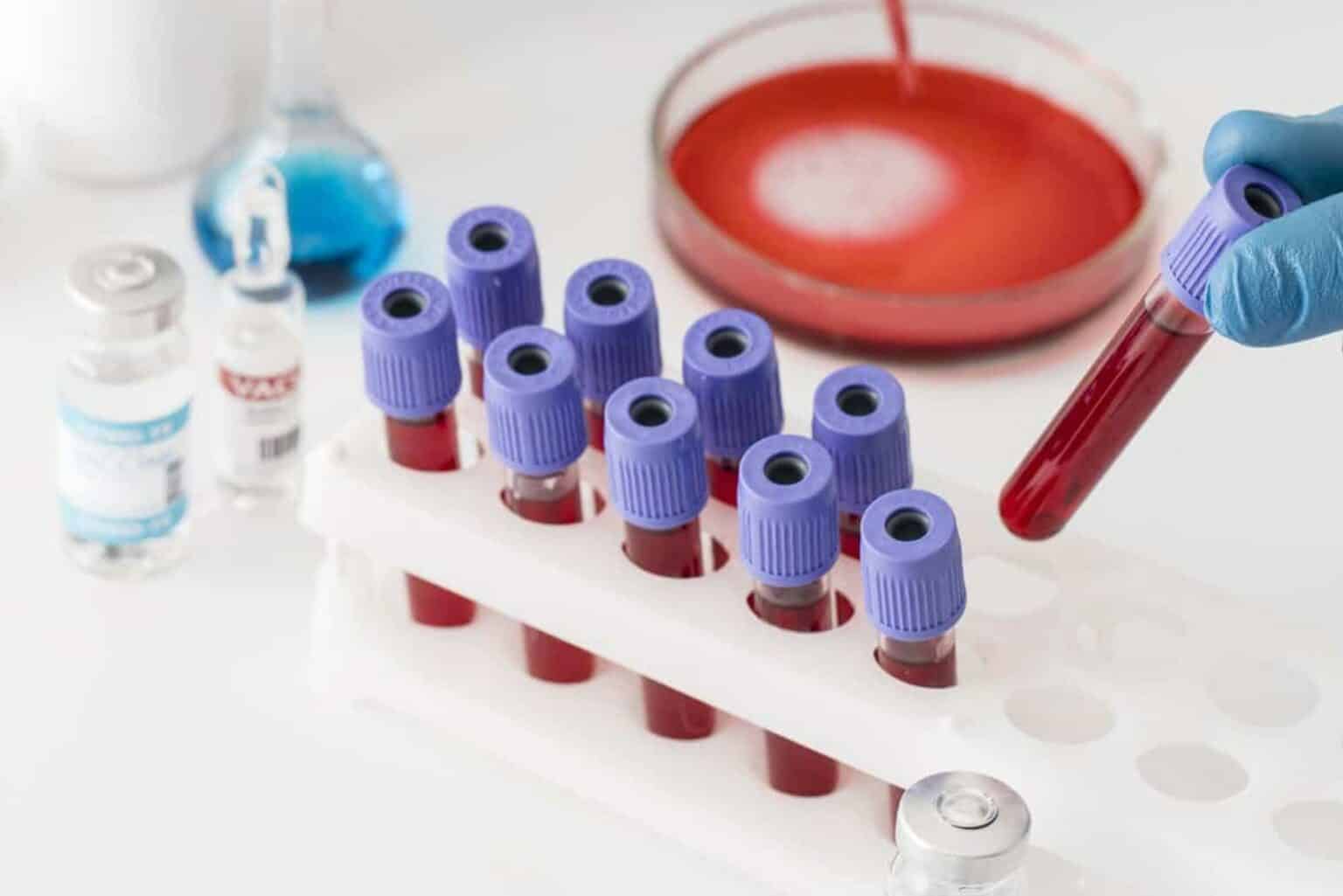 Medicina di Laboratorio - Azienda ULSS 8 Berica